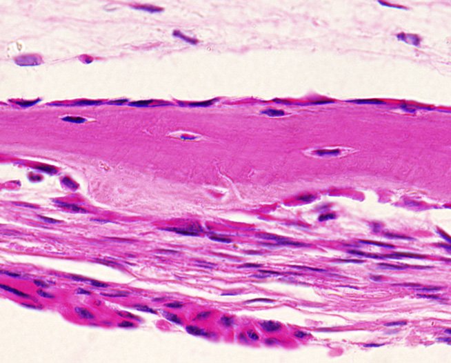 7-22 Bone – HISTOLOGY – MOL – MICROSCOPY ON LINE. INTERACTIVE HISTOLOGY